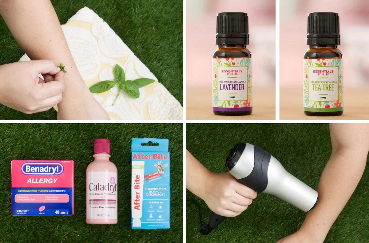 10 Easy And Effective Ways To Stop The Itch Of A Bug Bite – By Jillee Shop